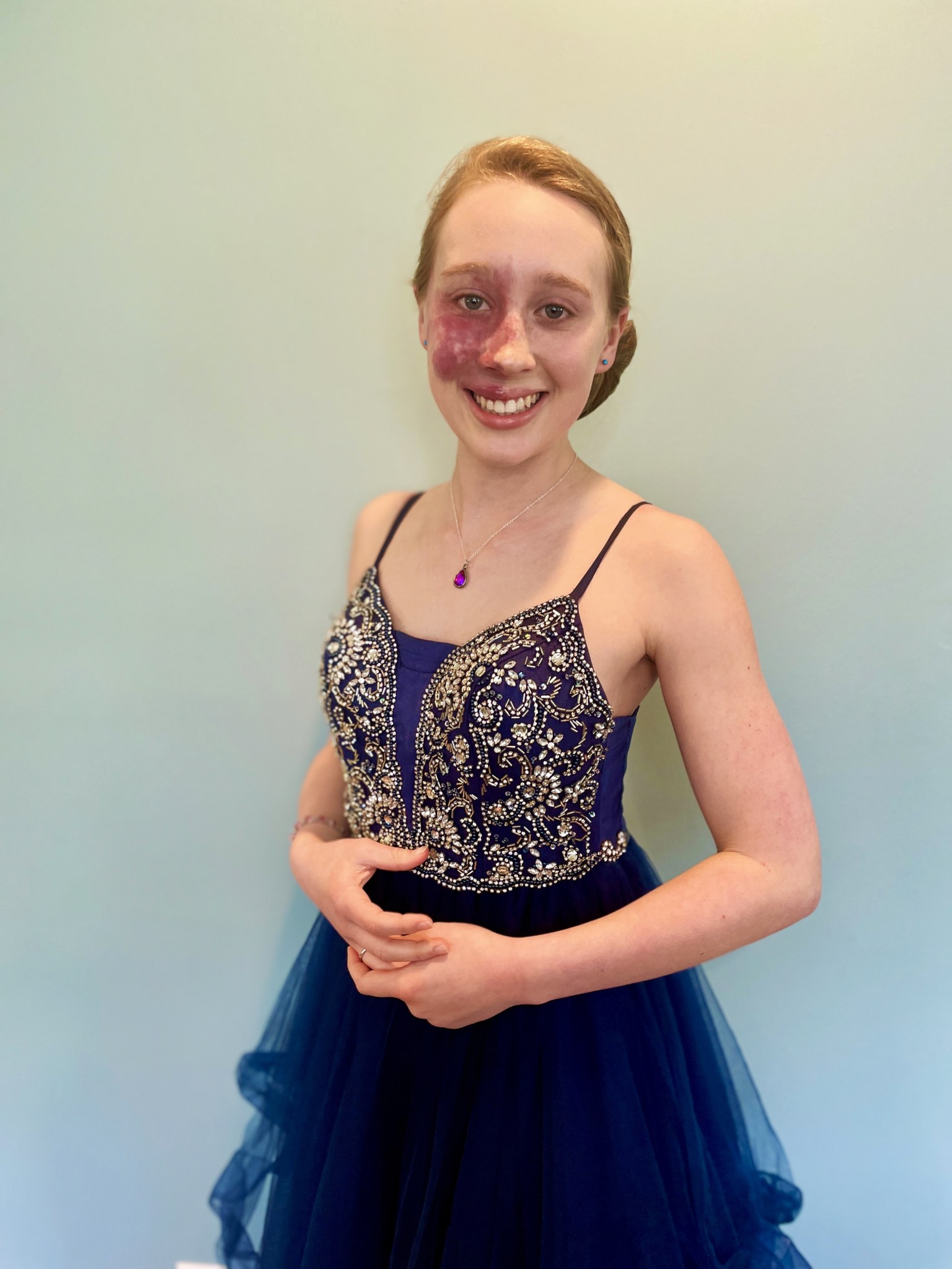 What Happened To Her Face? | Handling the questions with humor and grace.