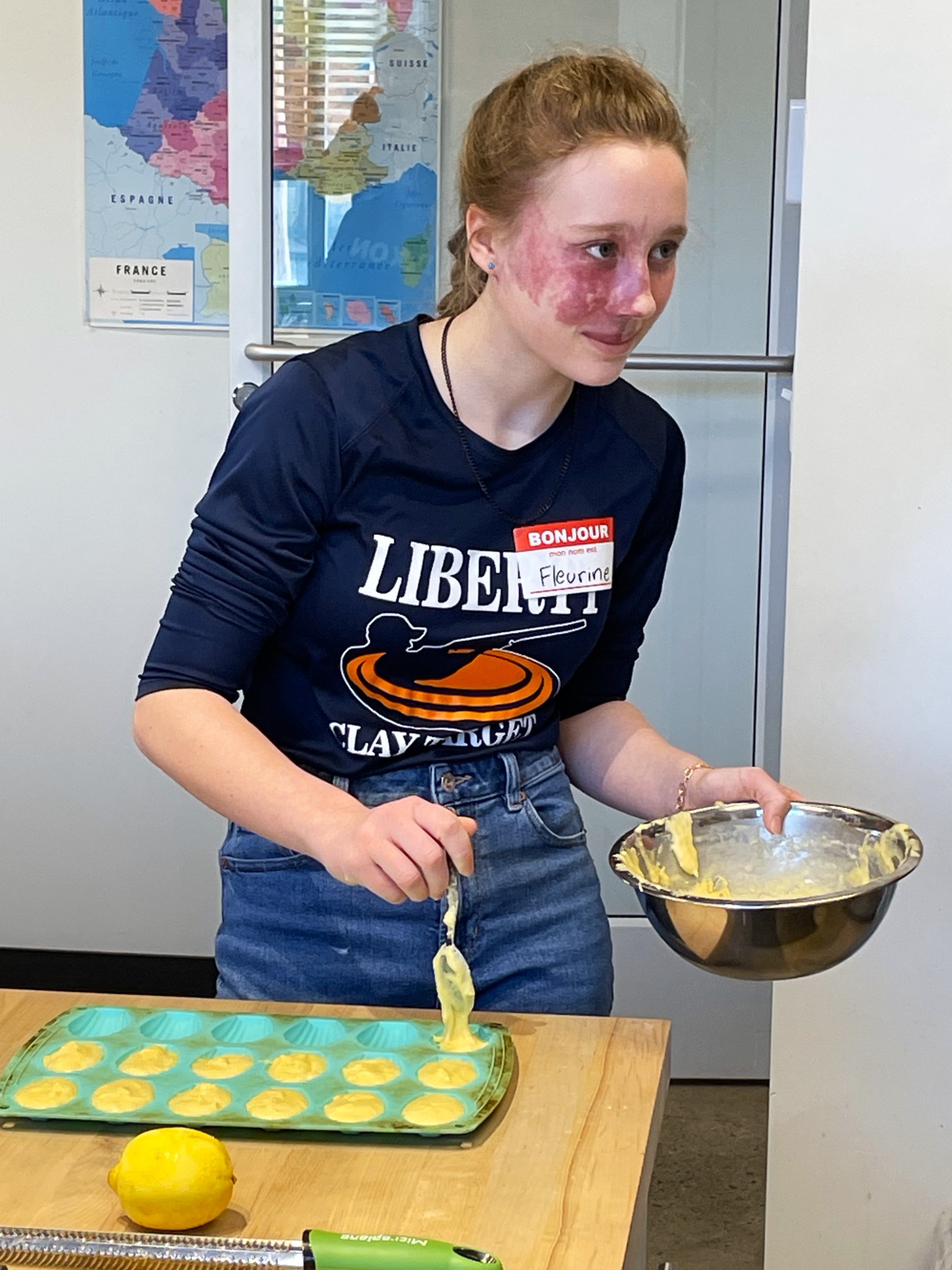 What Happened To Her Face? | Handling the questions with humor and grace.